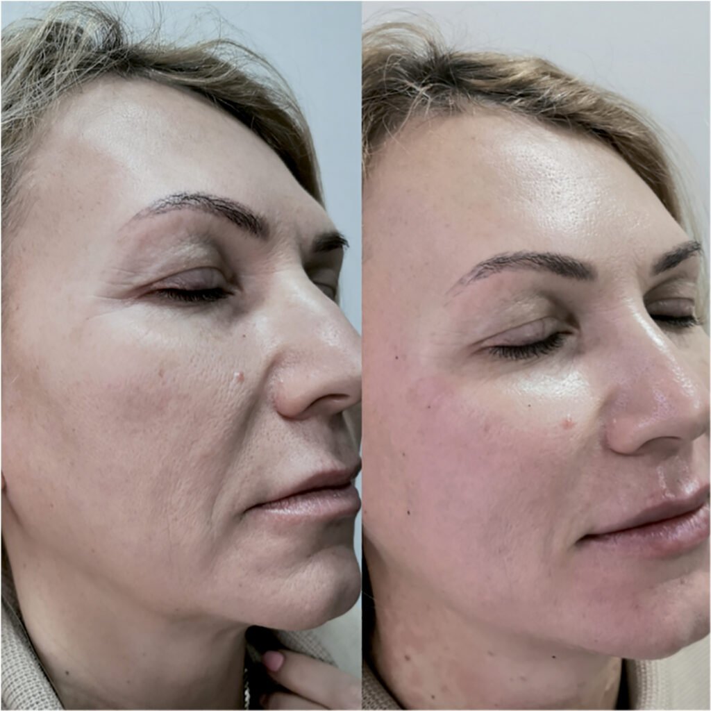 “JALUPRO” - PAKAITINĖ AMINORŪGŠČIŲ TERAPIJA